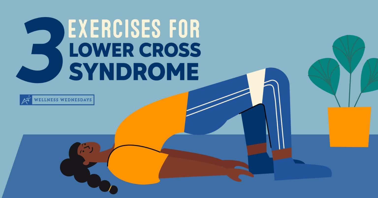 3 Lower Cross Syndrome Exercises | Airrosti